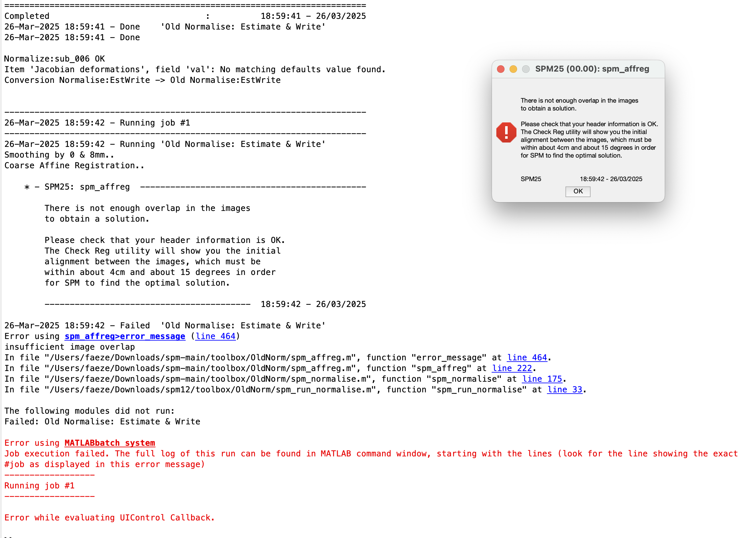 Error in normalization step DPARSFA | The R-fMRI Network
